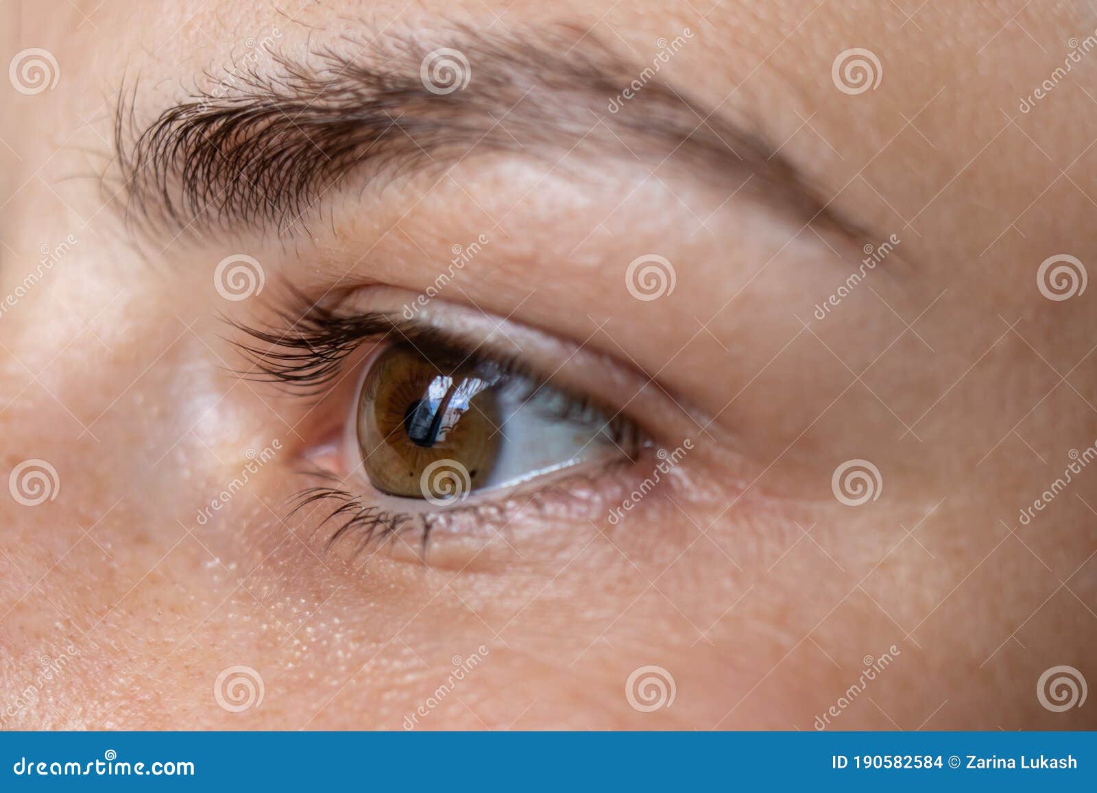 Macro Eye Photo. Keratoconus - Eye Disease, Thinning of the Cornea in ...