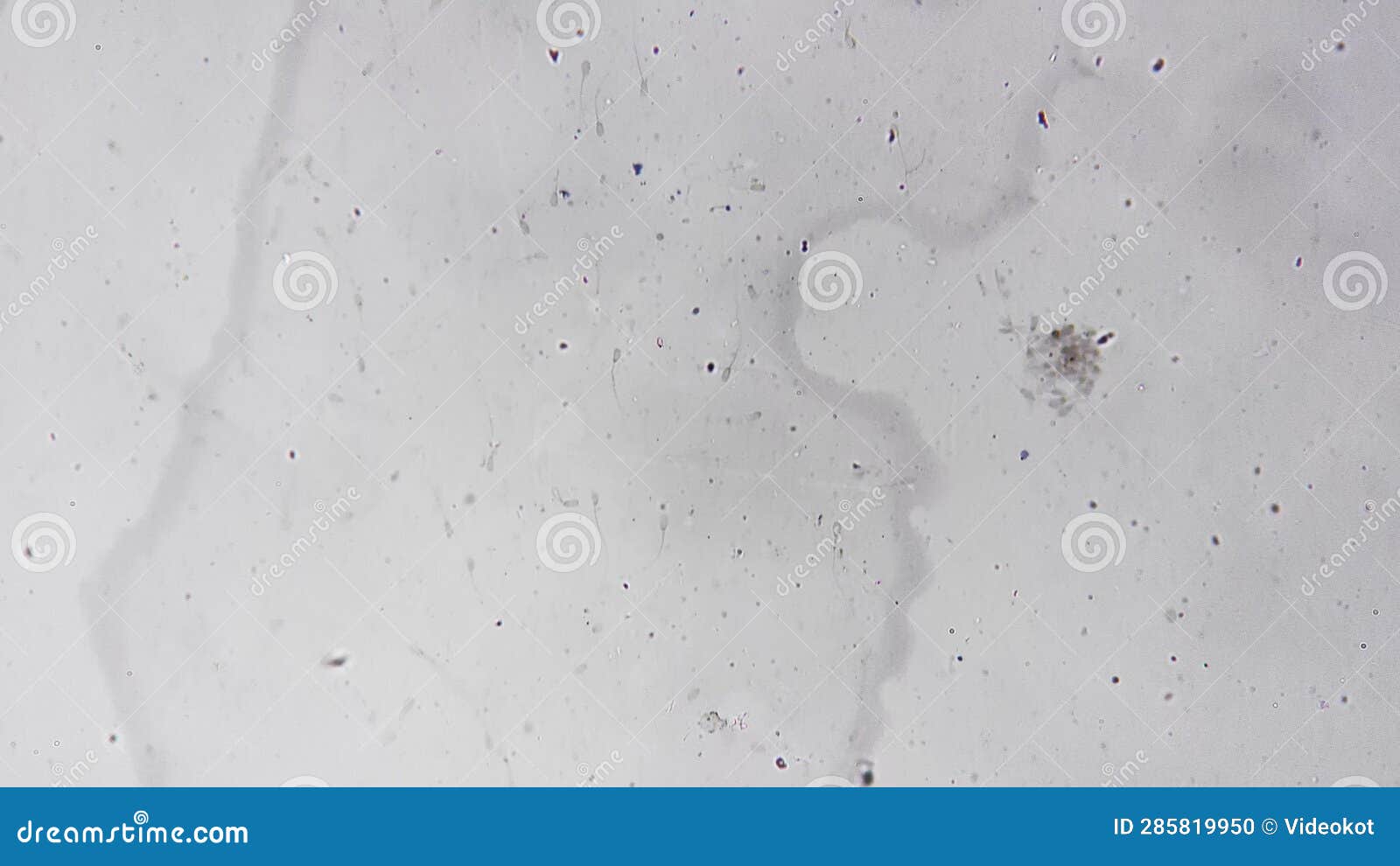 Macro Footage of Sperm Smear Sample Magnified Under Microscope 200x and ...