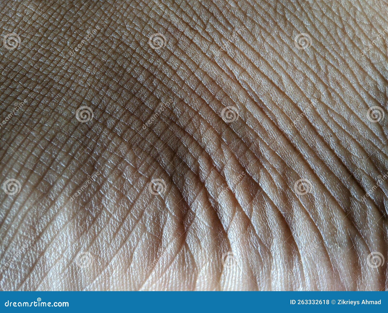 Macro of hand skin texture stock photo. Image of white - 263332618