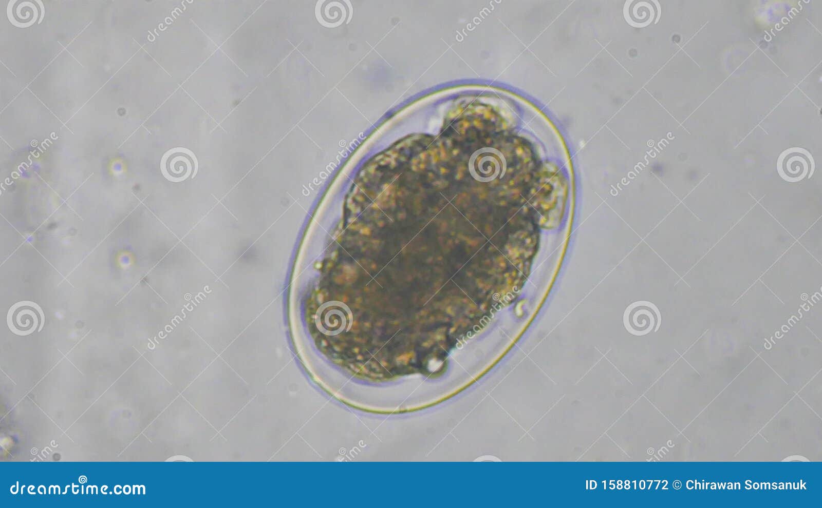 Strongyle Eggs Under The Microscope, Uncinaria/Ancylostoma, Hookworm ...
