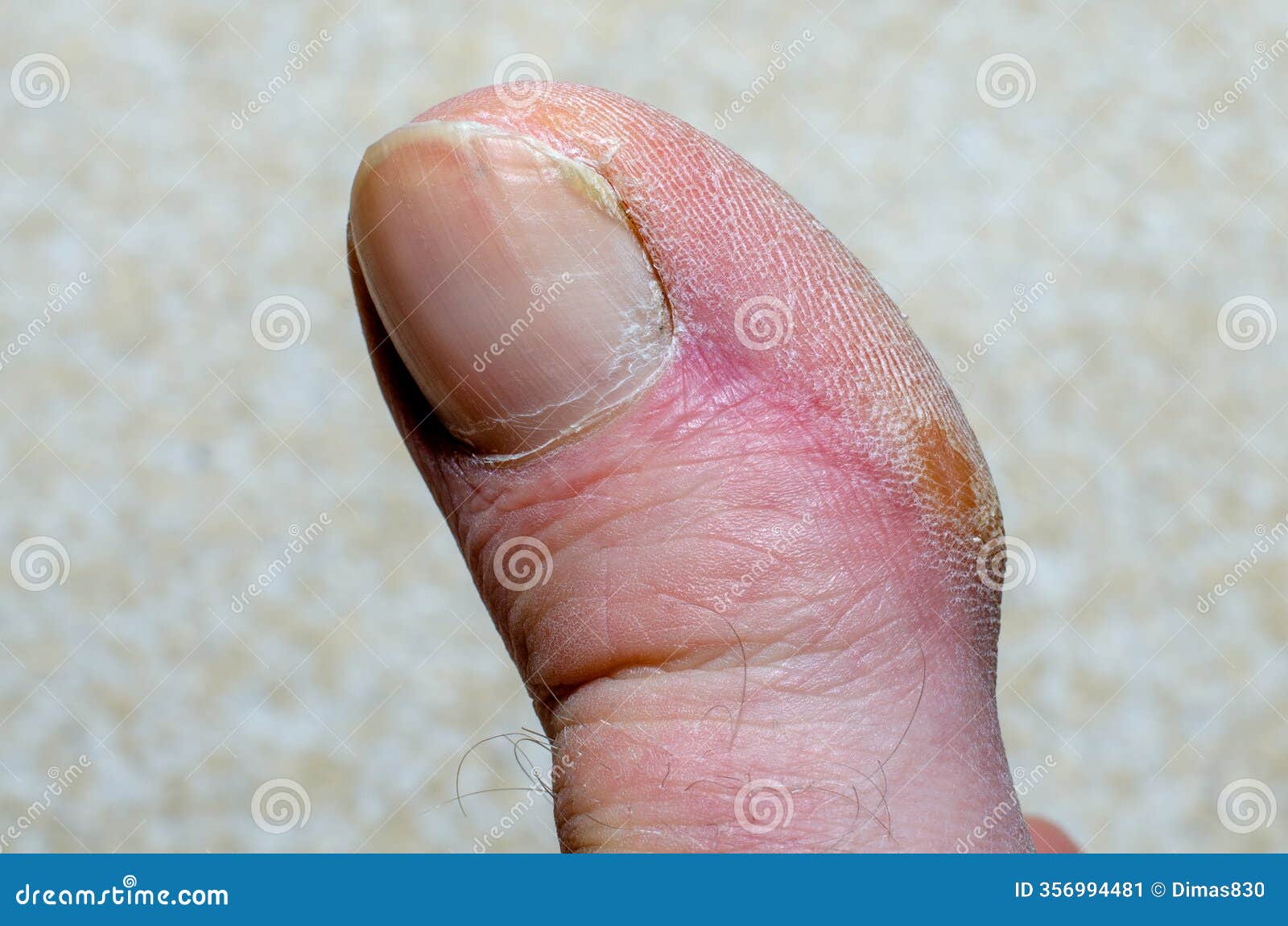 Macro of a Human Thumb with Skin Texture Stock Image - Image of macro ...