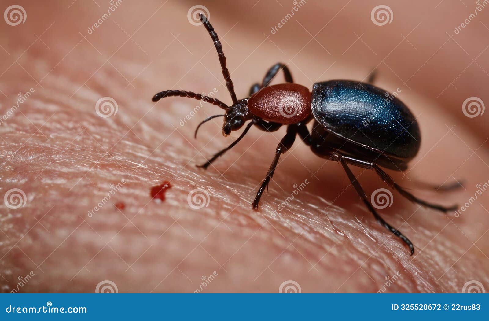 Macro Image of a Beetle on Human Skin with a Drop of Blood beside it ...
