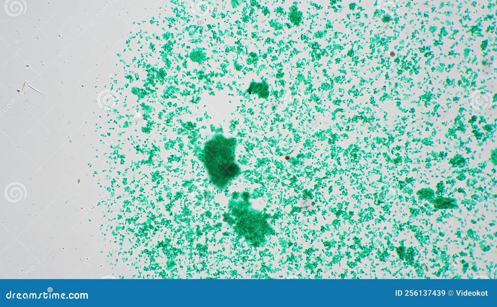 Macro of Microzyme Whole Mount Concentration Magnified Under Microscope ...