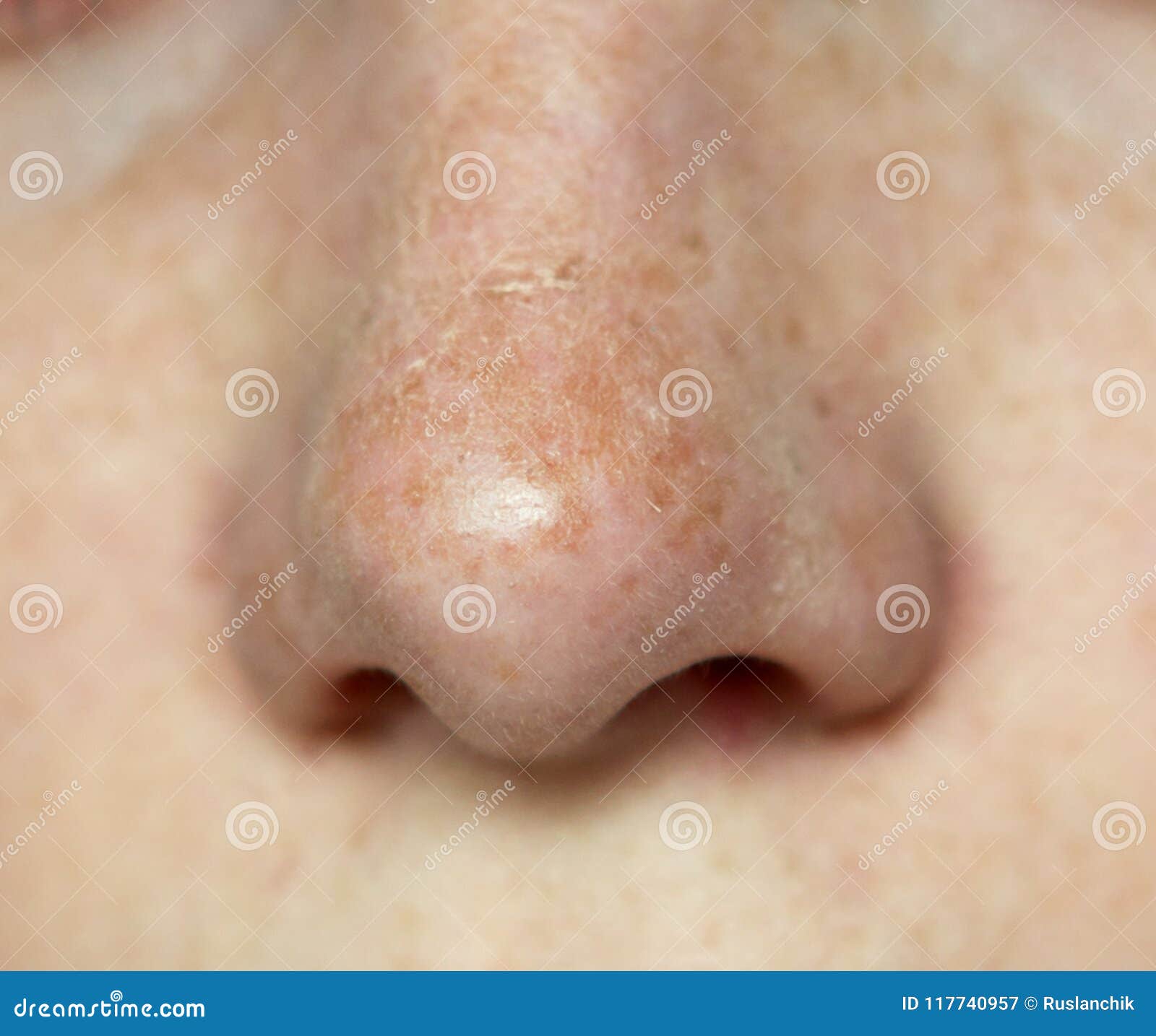 Macro of nose stock image. Image of skin, smell, human - 117740957