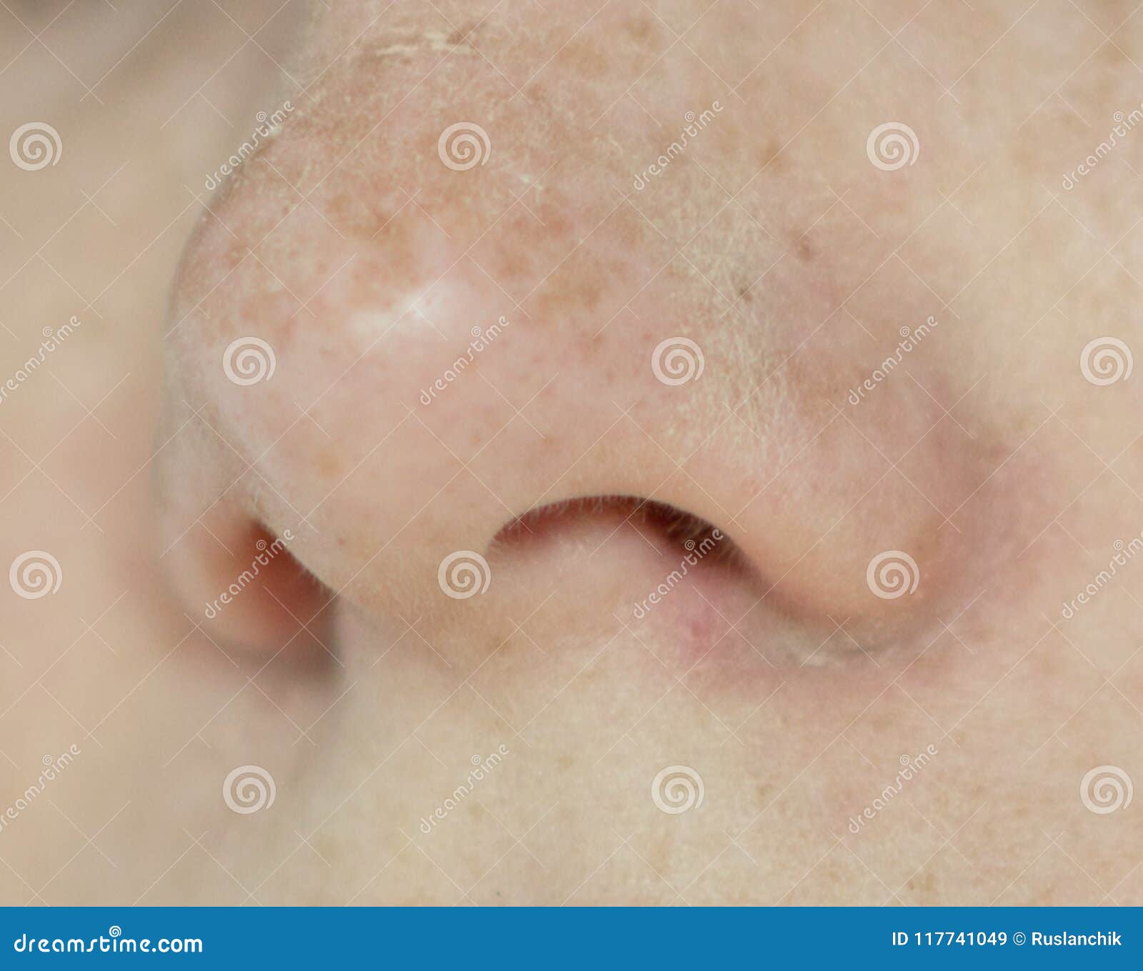 Macro of nose stock image. Image of close, healthy, smell - 117741049