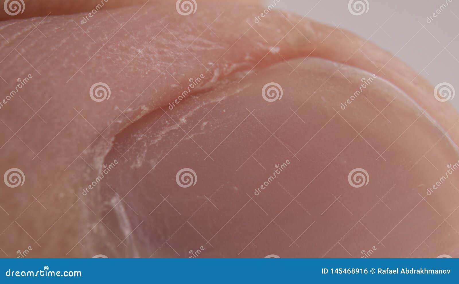 Macro Photo of Big Finger Nail. Cuticles Manicure Stock Photo - Image ...