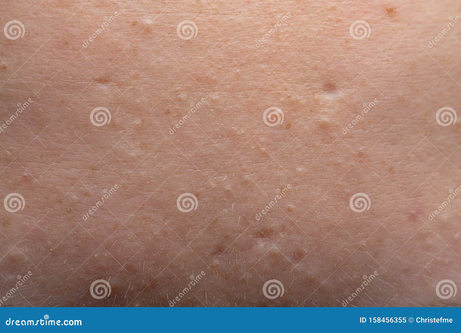 Macro Photo of the Human`s Forehead Texture Stock Image - Image of ...
