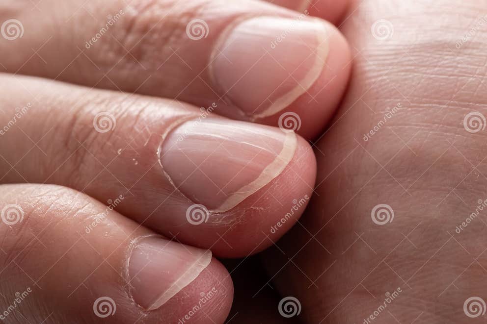 Macro Photo of Vertical Ridges in Fingernails Stock Image - Image of ...