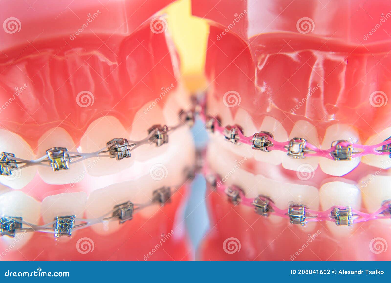 On Macro Photos Shows How the System of Brackets is Arranged Stock ...