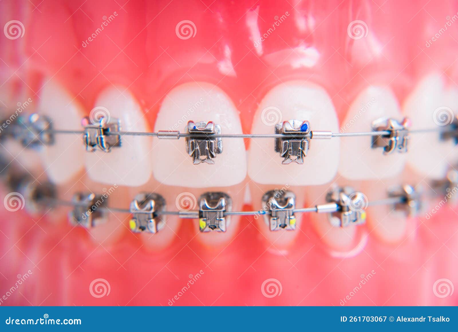 On Macro Photos Shows How the System of Brackets is Arranged Stock ...