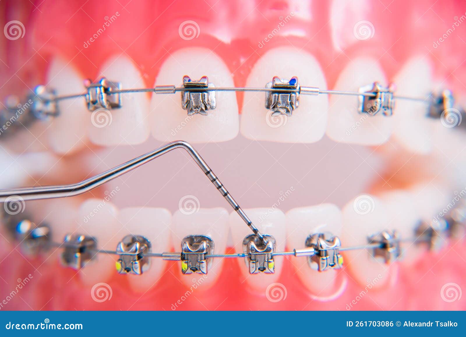 On Macro Photos Shows How the System of Brackets is Arranged Stock ...