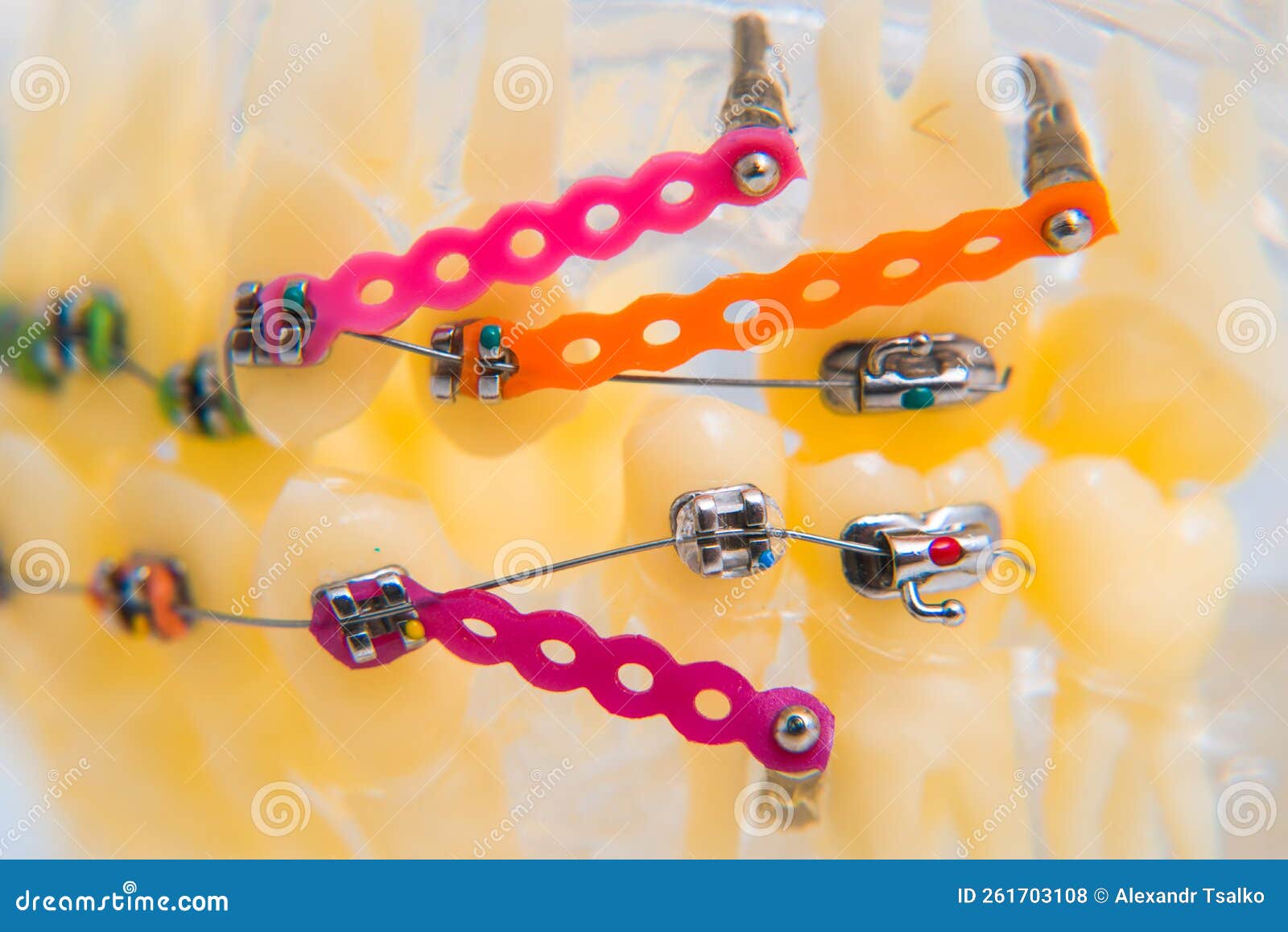 On Macro Photos Shows How the System of Brackets is Arranged Stock ...