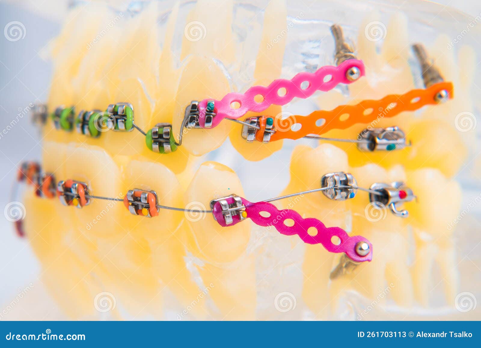 On Macro Photos Shows How the System of Brackets is Arranged Stock ...