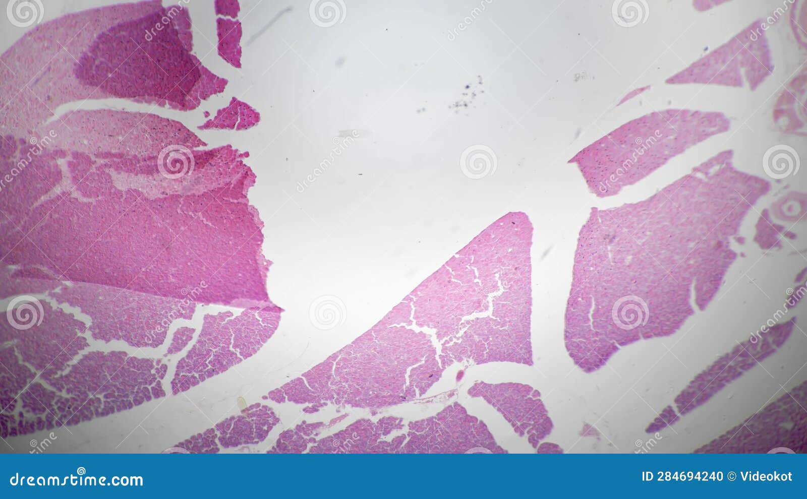 Macro Scientific Slide of Human Pancreas Tissue Magnified Under ...