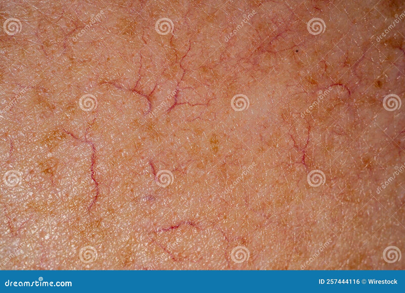 Macro Shot of the Human Skin with Veins. Stock Photo - Image of ...
