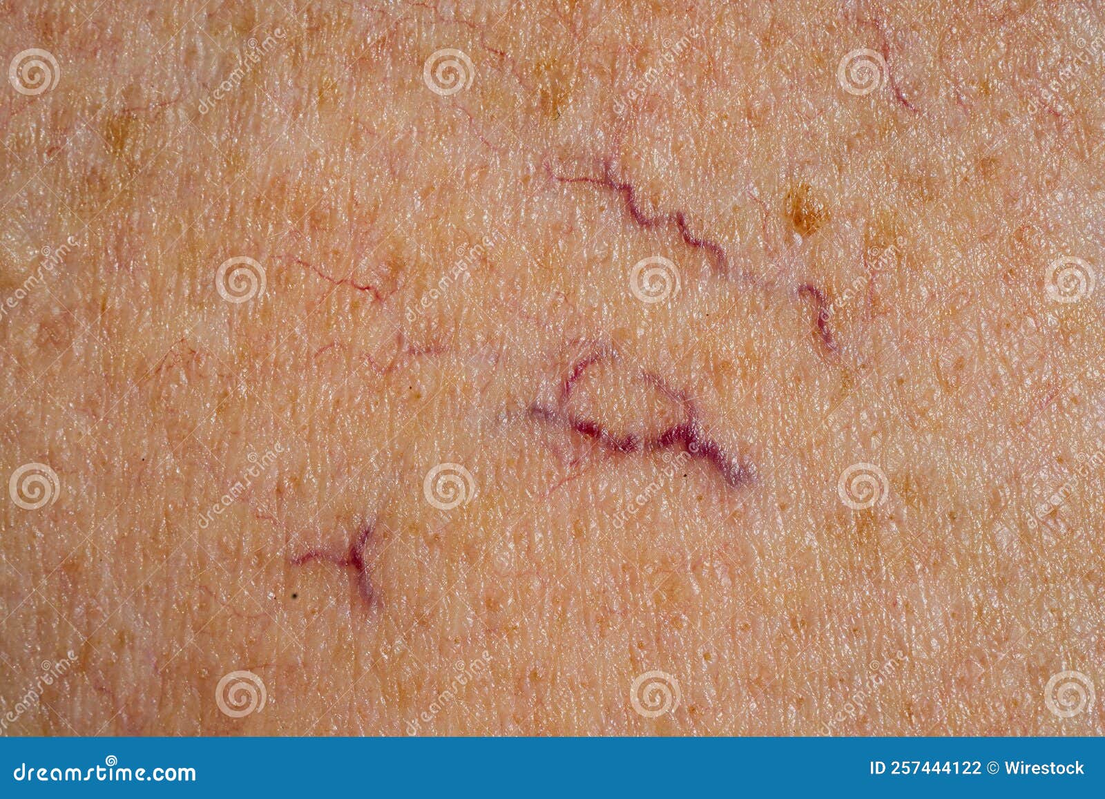 Macro Shot of the Human Skin with Veins. Stock Photo - Image of surface ...