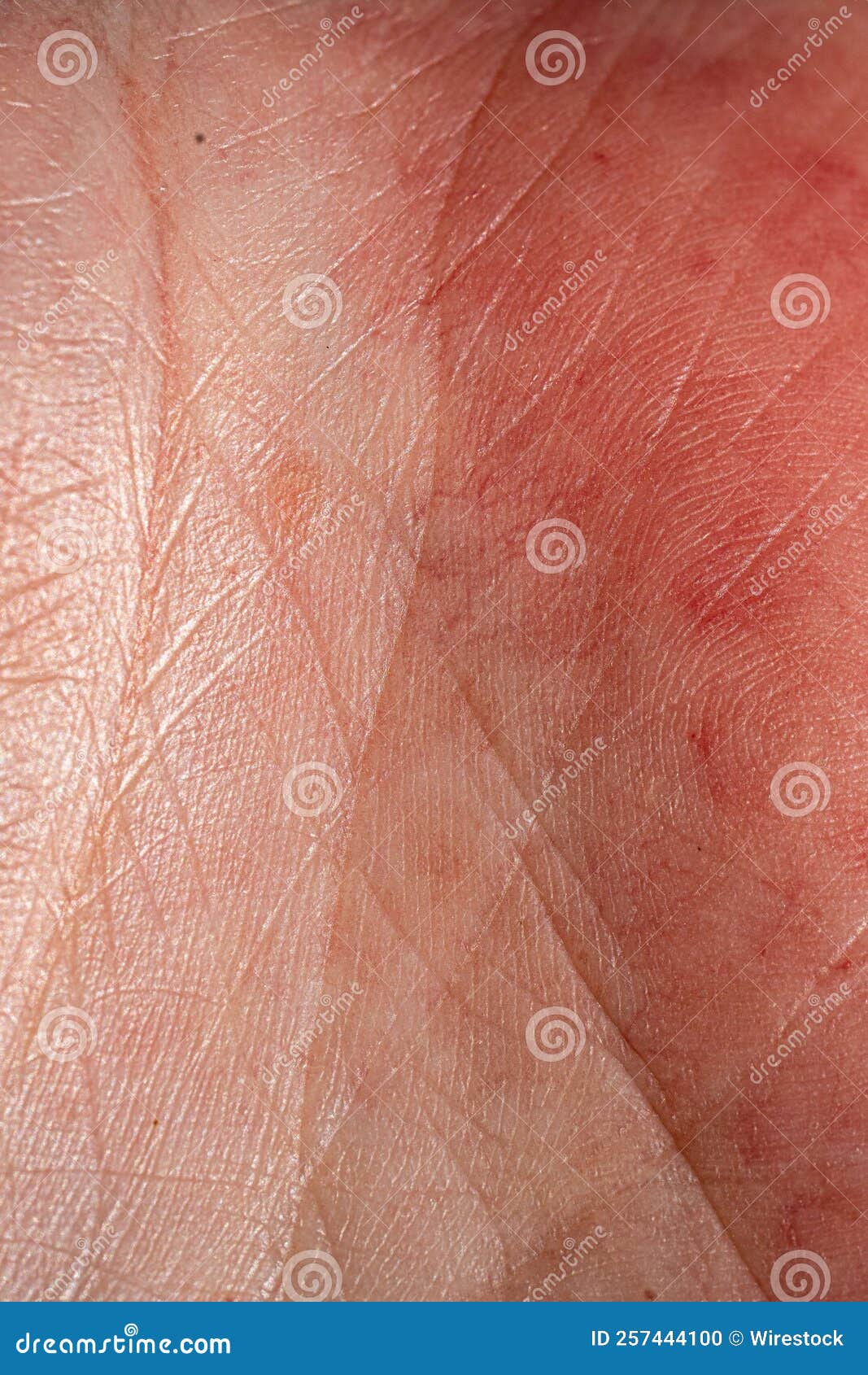 Macro Vertical Da Textura Da Pele Humana. Foto de Stock - Imagem de ...