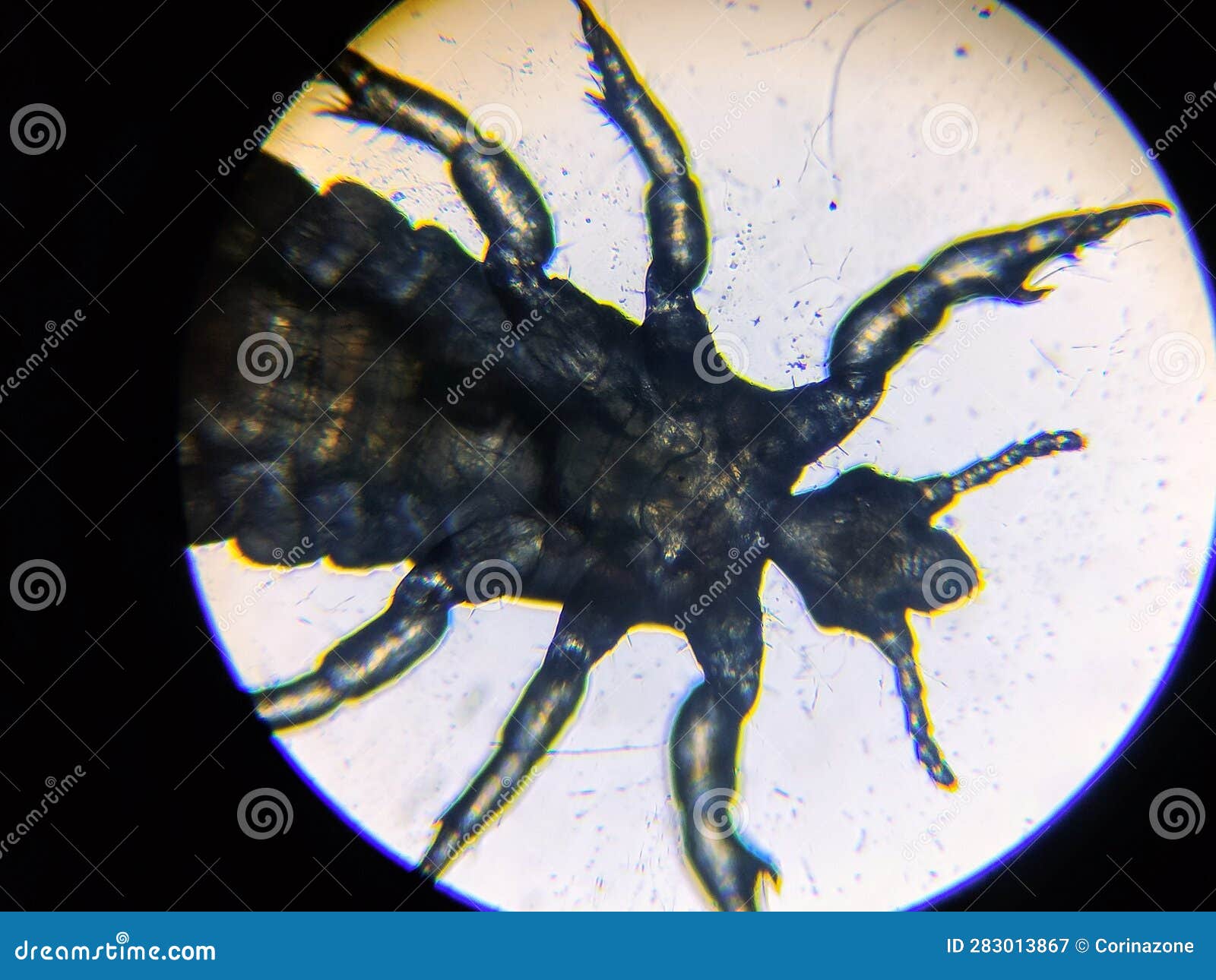 Macro view of head louse stock image. Image of louse - 283013867