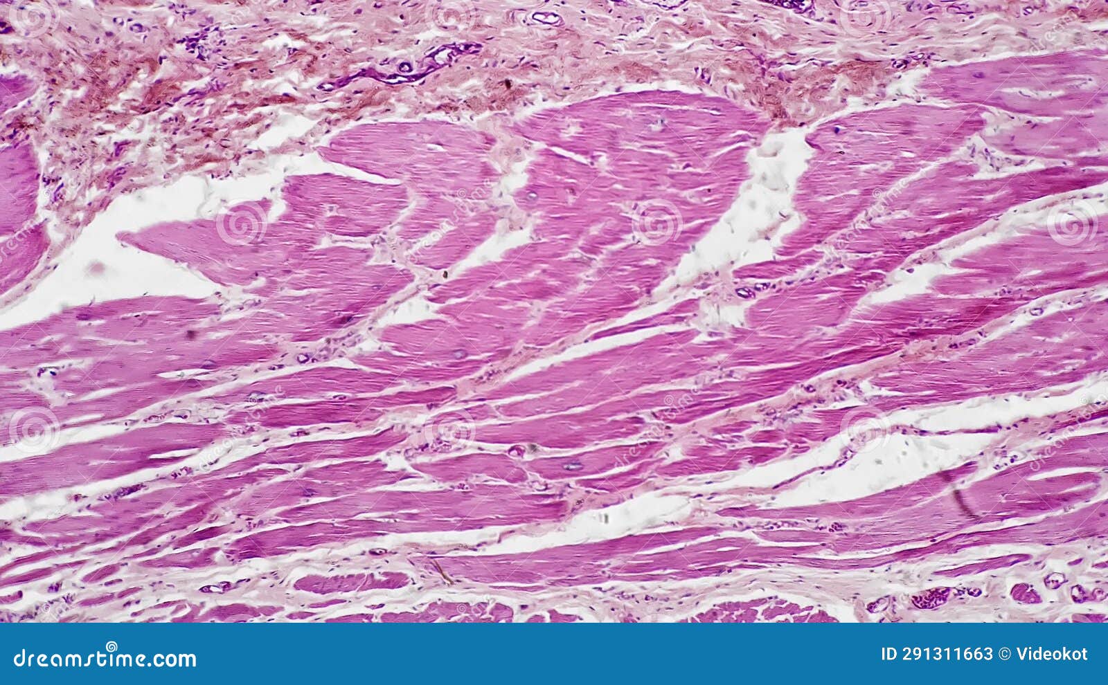 Macro View of Human Stomach in Section Studied in Lab Under Microscope ...