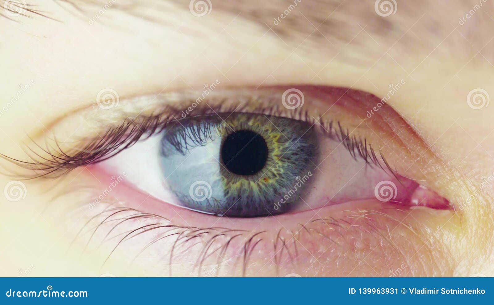 Macro View of Pupil Constriction Process in Human Eye Stock Video ...