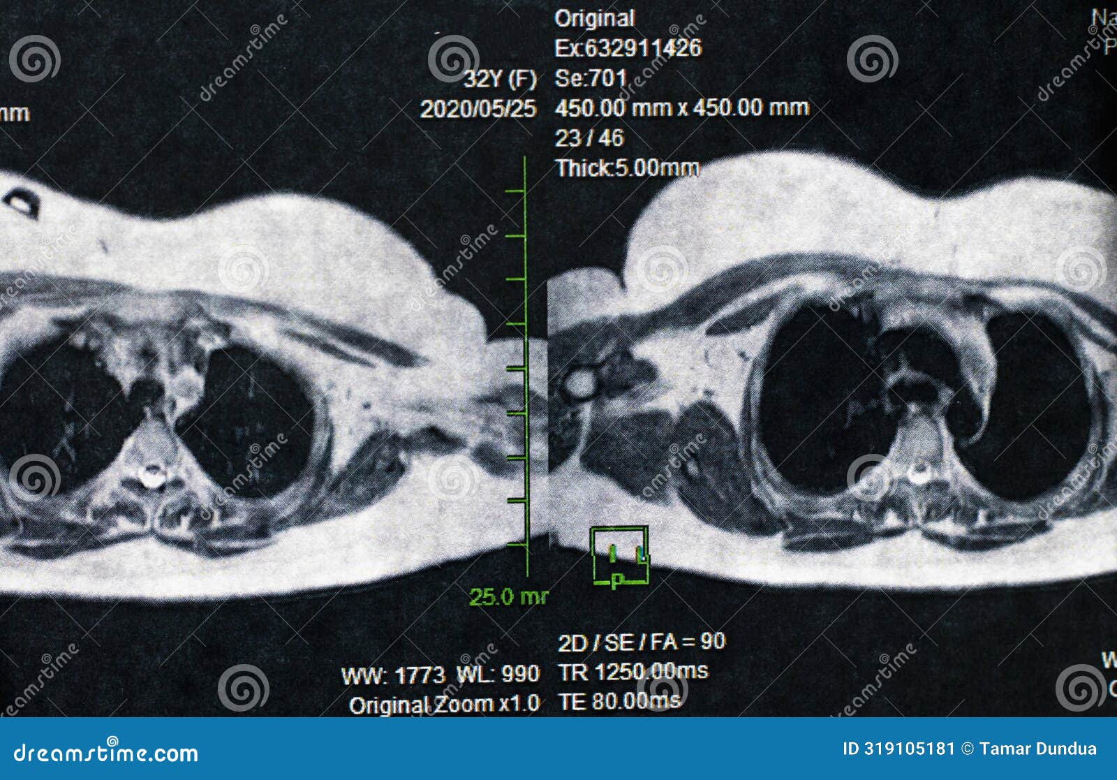 Magnetic Computer Tomography Stock Image - Image of magnetic ...