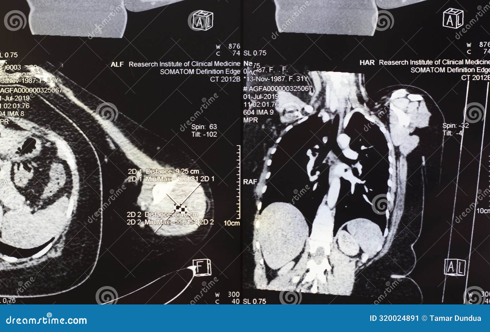 Magnetic Computer Tomography Stock Image - Image of magnetic, science ...