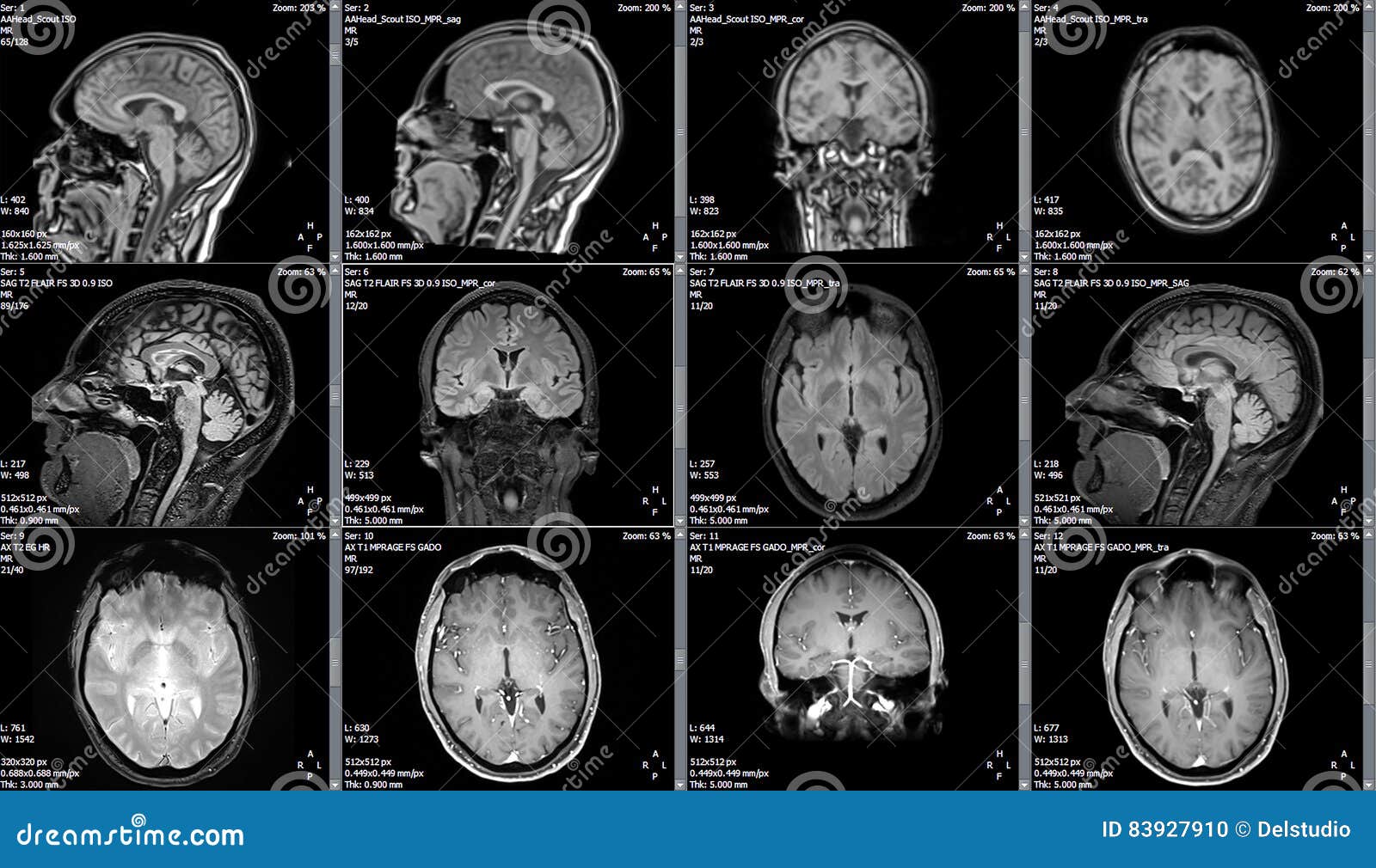 An Image Of Neurons Involved In Emotion Regulation And Anxiety, Such As ...