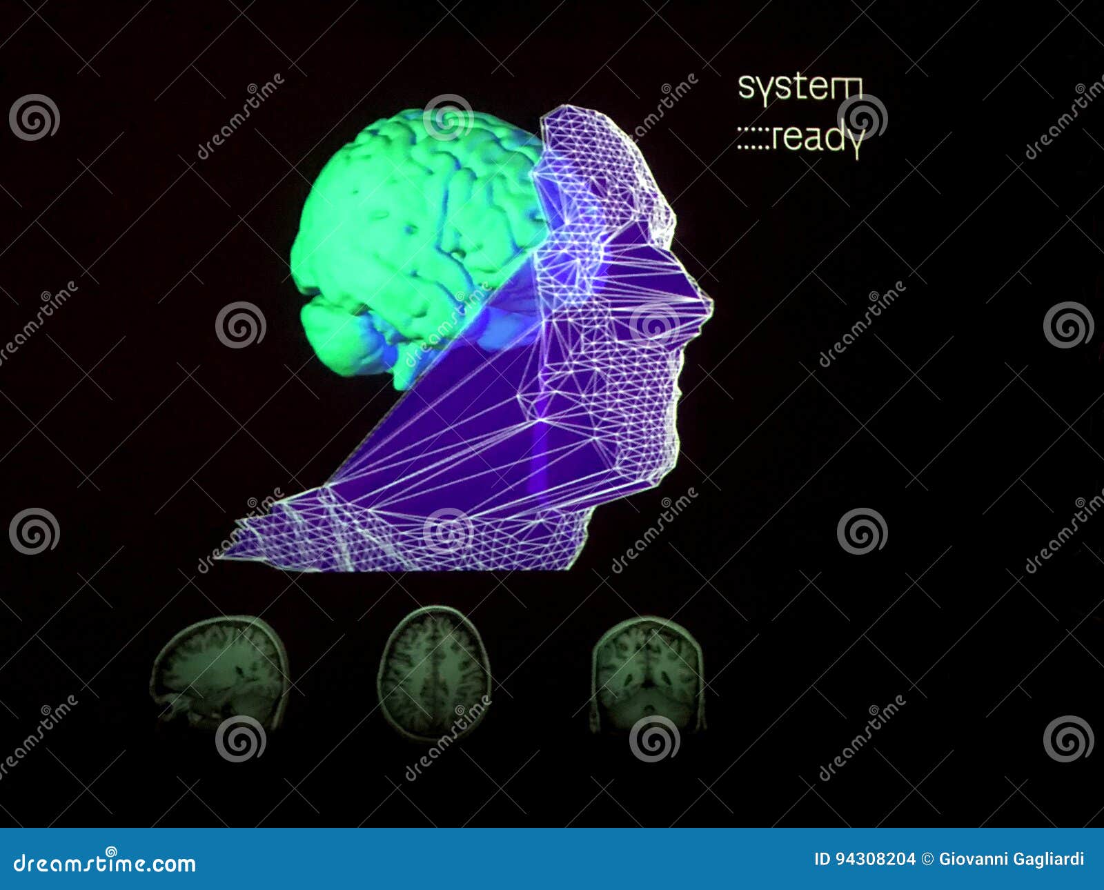 Magnetic Resonance Image of Male Human Brain Stock Photo - Image of ...
