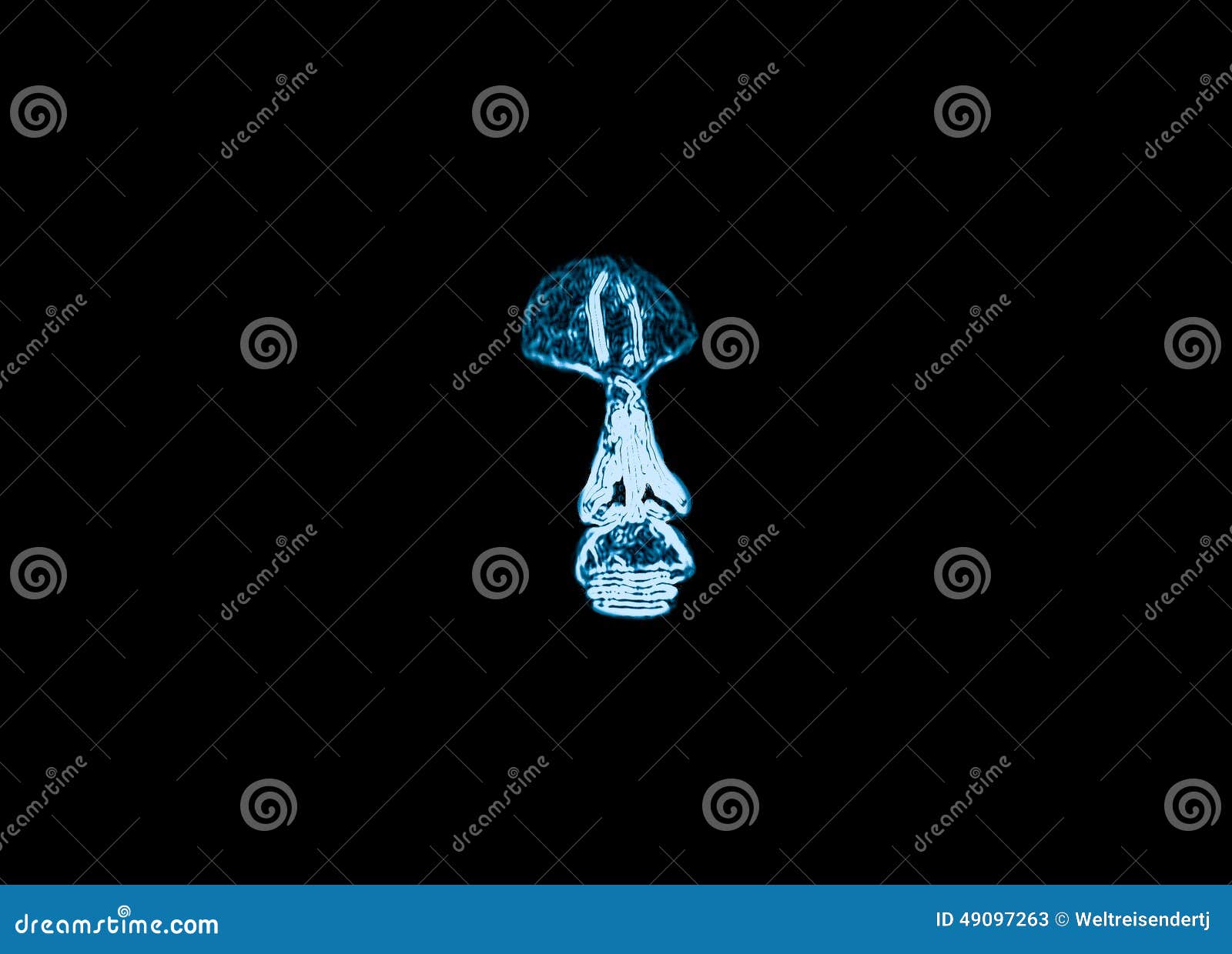 Magnetic Resonance Image (MRI) of the Head Face Stock Image - Image of ...