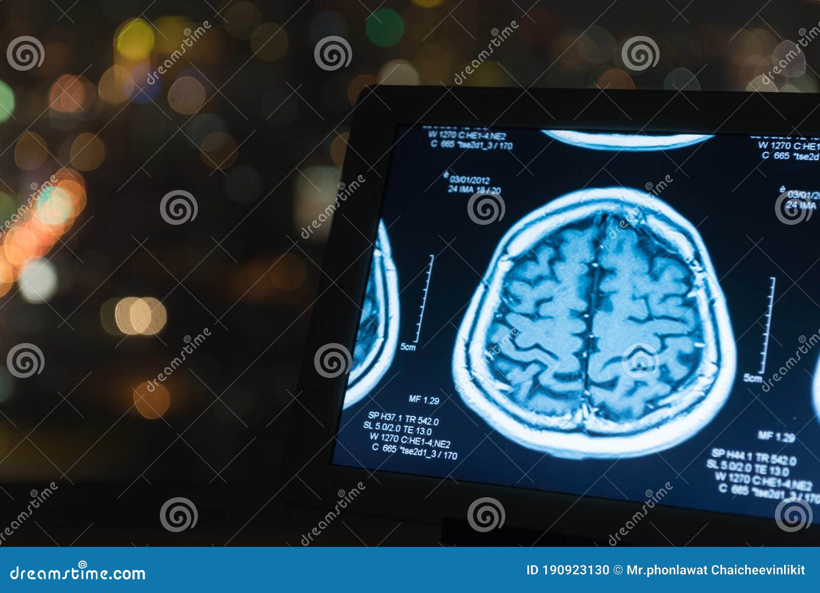 Brain scan images stock photo. Image of cancer, radiology - 190923130