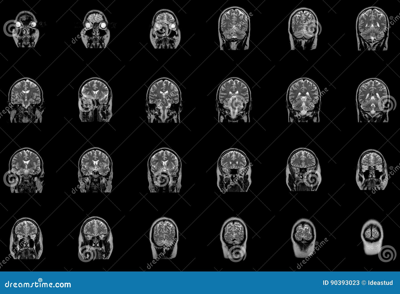 Brain Stem Parts Anatomical Model In Educational Labeled Outline ...