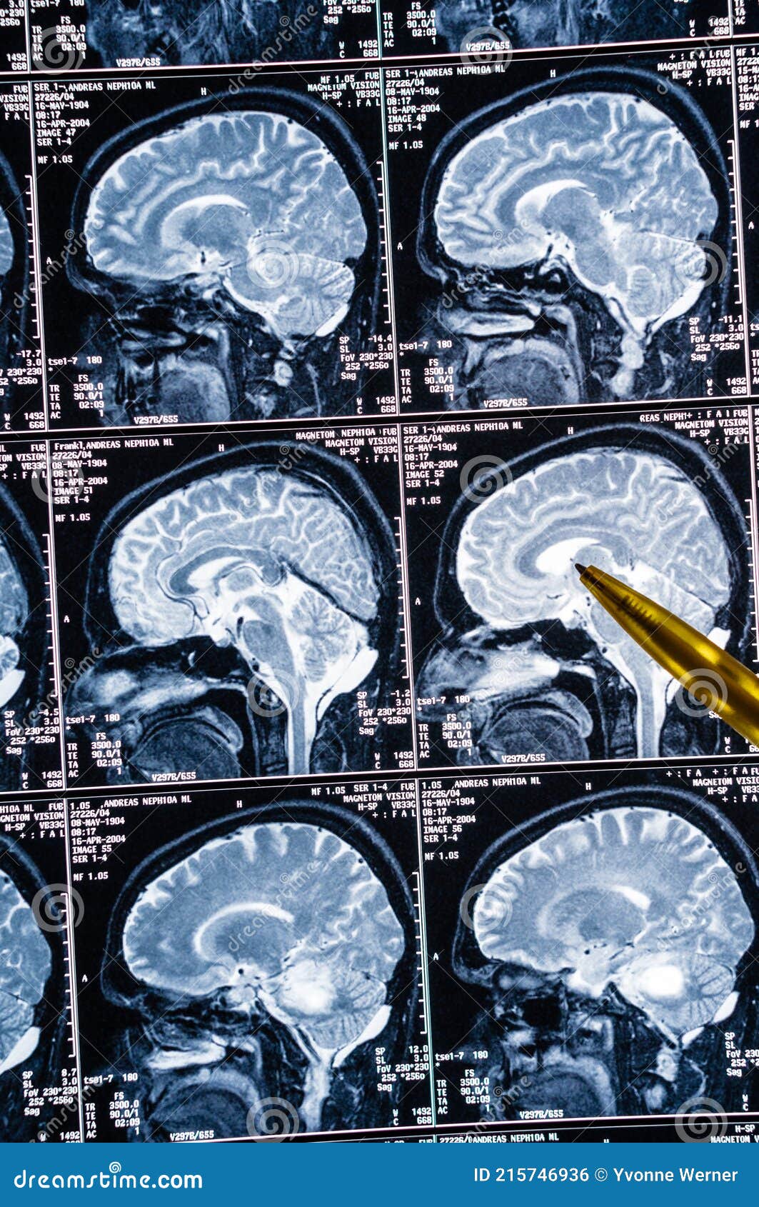 Magnetic Resonance Imaging, MRI, Computed Tomography, X-ray Image Stock ...