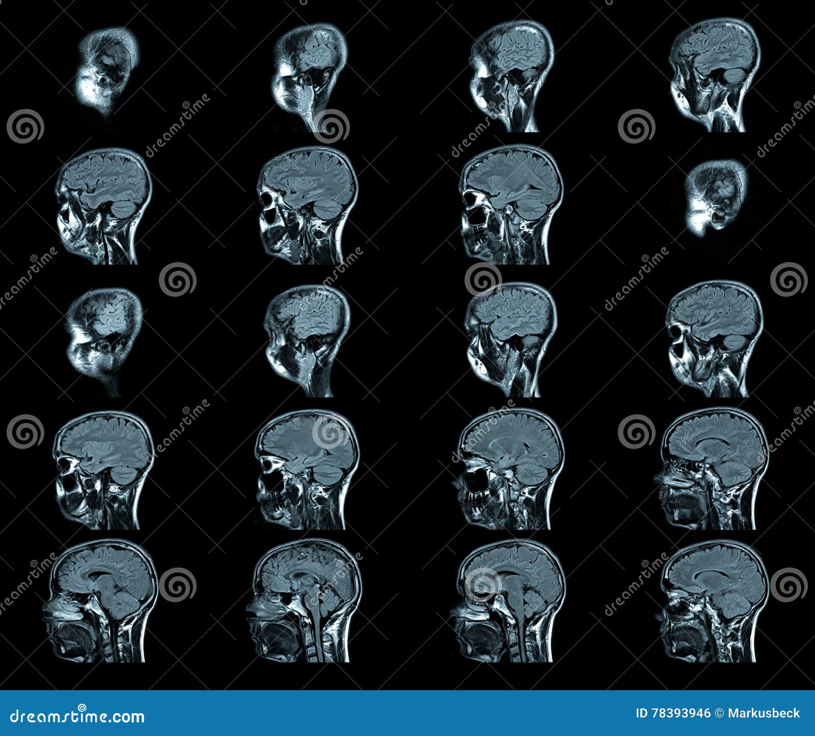 Magnetic Resonance Imaging, MRI MRT Head Royalty-Free Stock Image ... Magnetic Resonance Imaging, MRI MRT Head Royalty-Free Stock Image ...