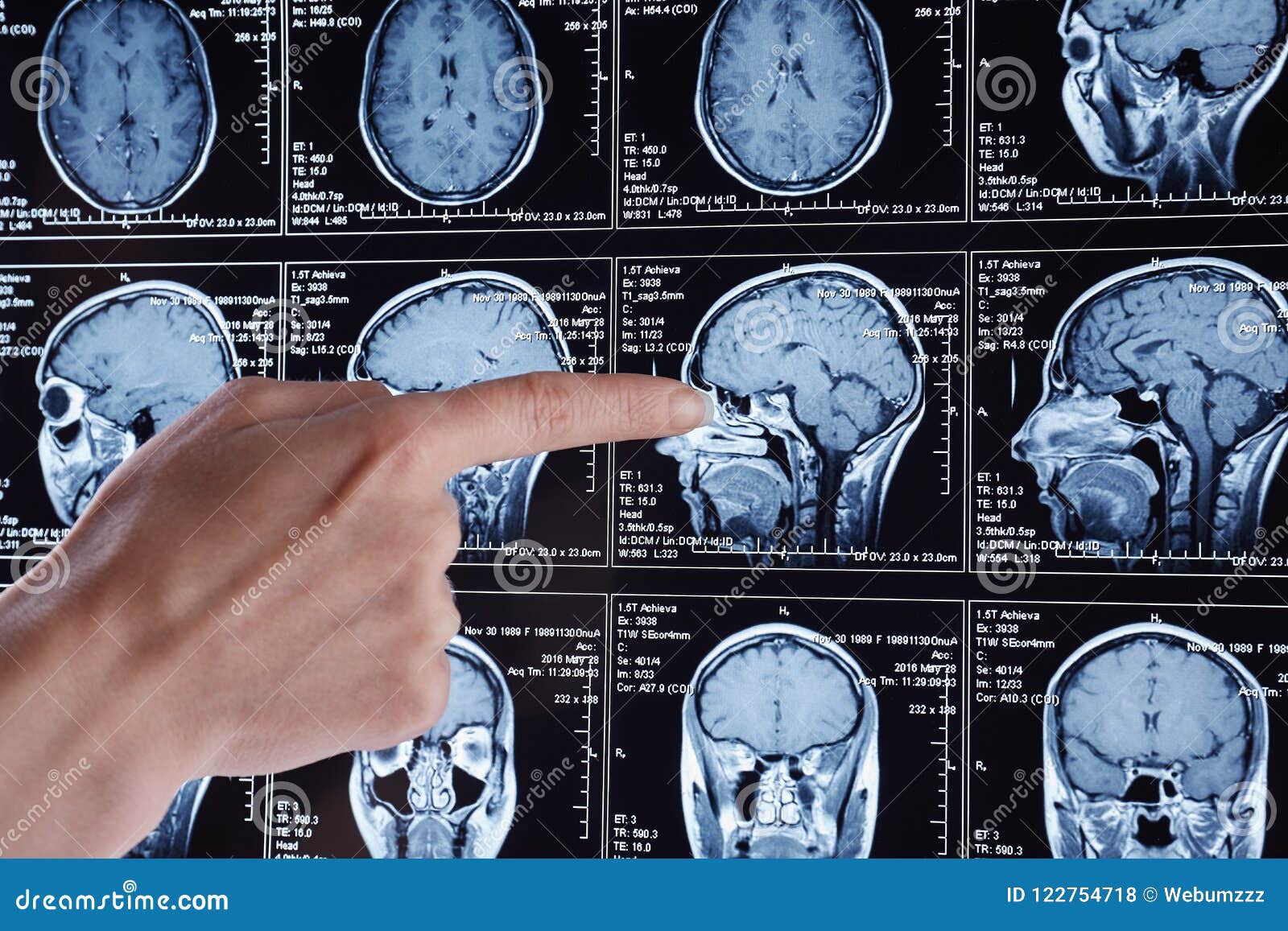 Magnetic Resonance Scan of the Brain. MRI Head Scan Stock Photo - Image ...