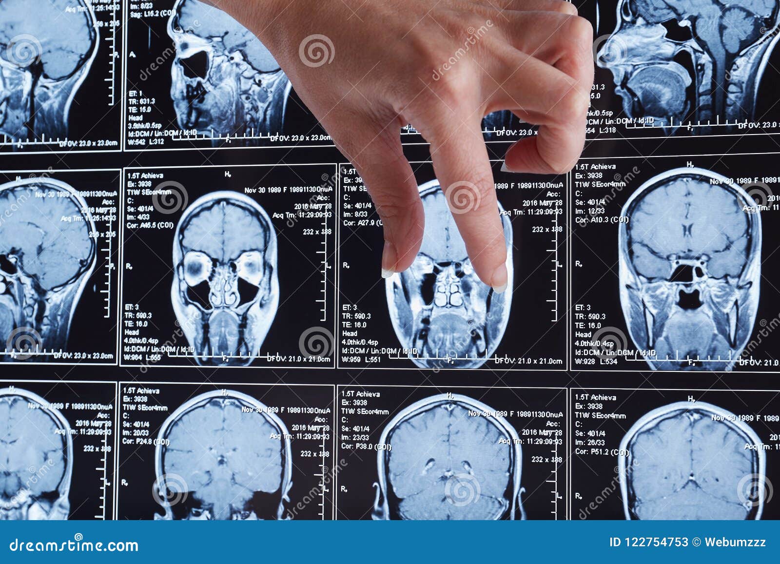 Magnetic Resonance Scan of the Brain. MRI Head Scan Stock Image - Image ...