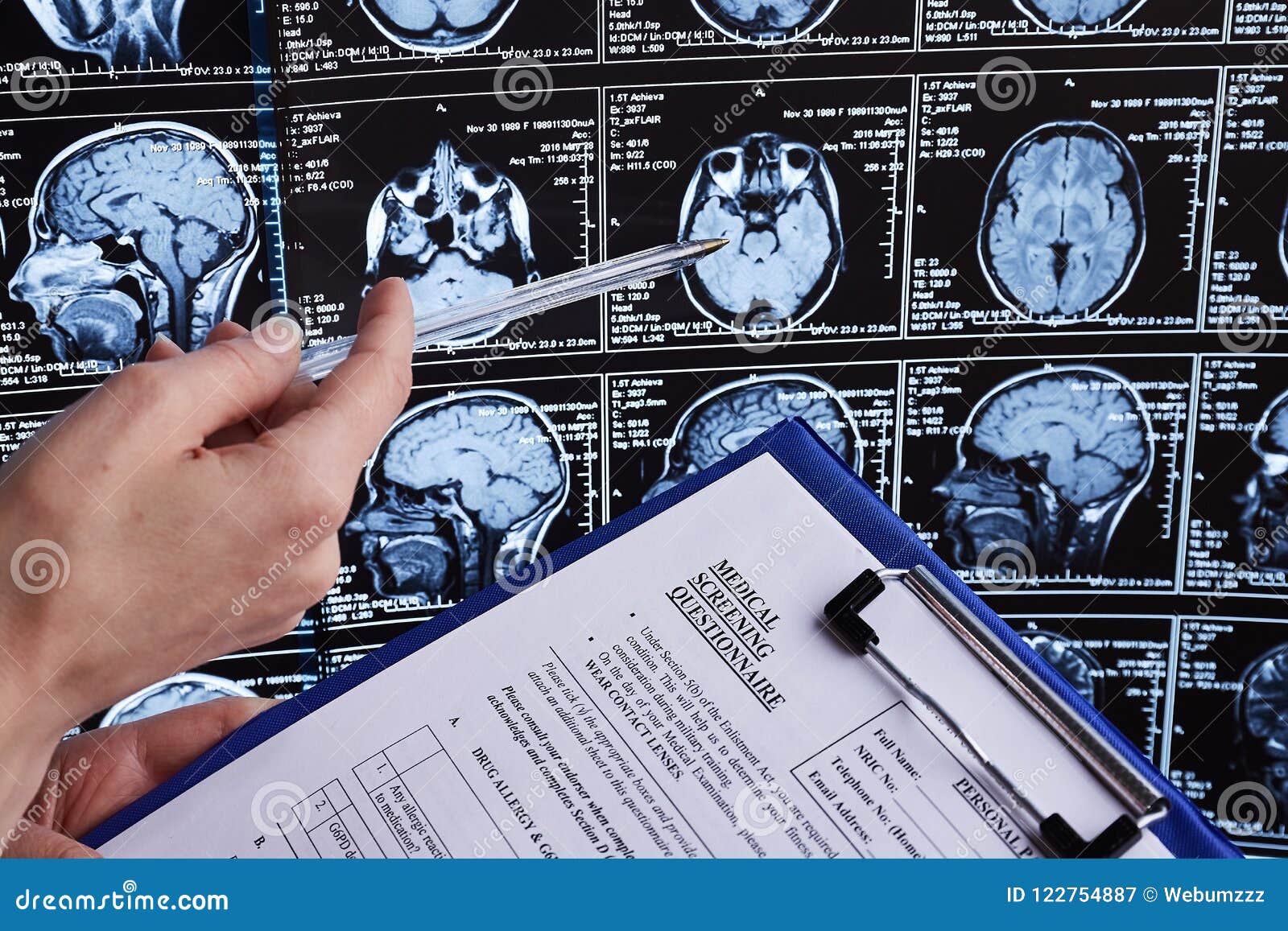 Magnetic Resonance Scan of the Brain. MRI Head Scan Stock Image - Image ...