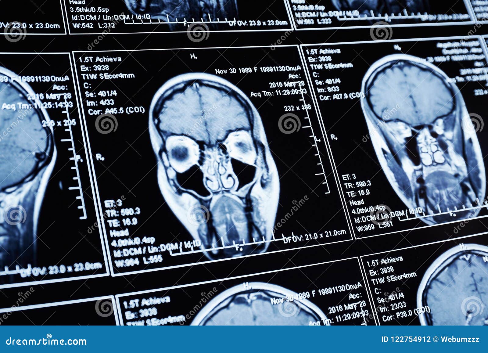 Magnetic Resonance Scan of the Brain. MRI Head Scan Stock Photo - Image ...