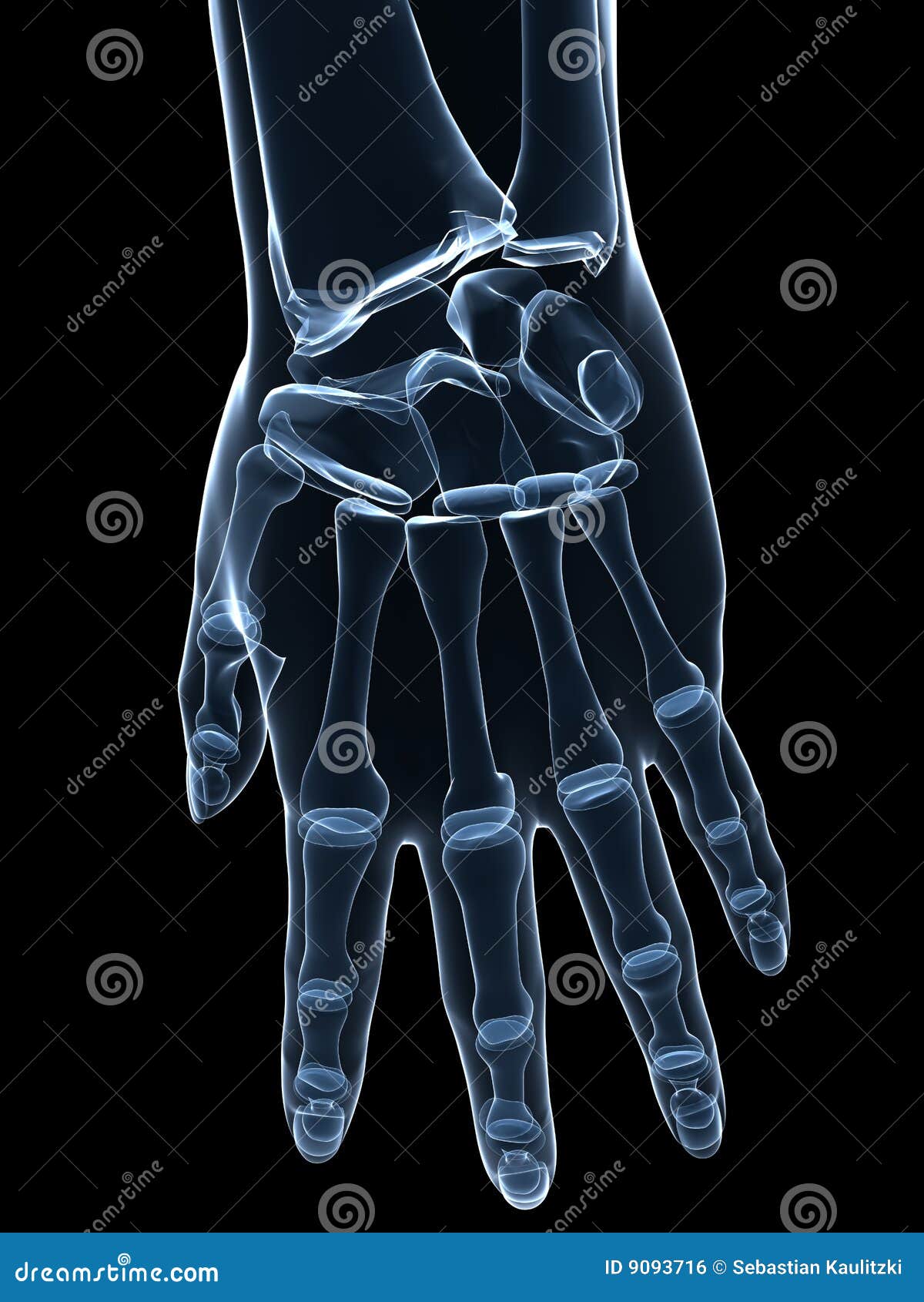 Main de rayon X illustration stock. Illustration du doigts - 9093716