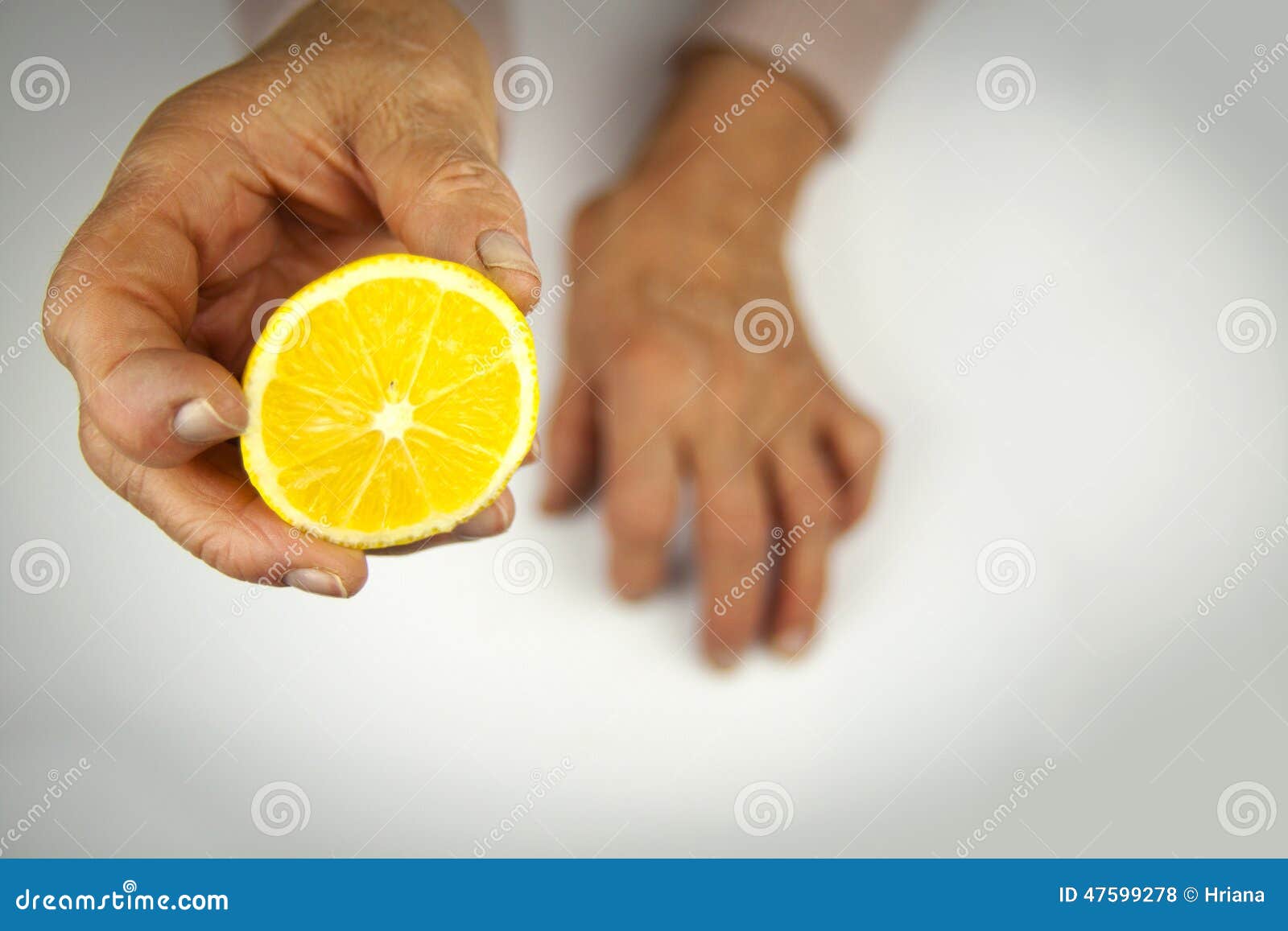 Mains De Rhumatisme Articulaire Photo stock - Image du santé, fond ...