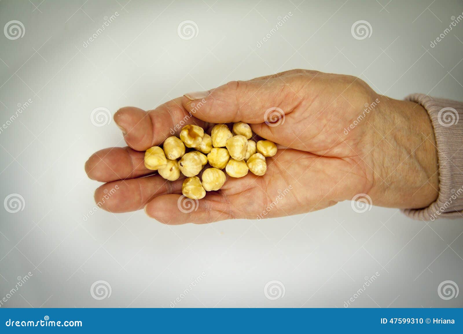 Mains De Rhumatisme Articulaire Photo stock - Image du rhumatisme, main ...