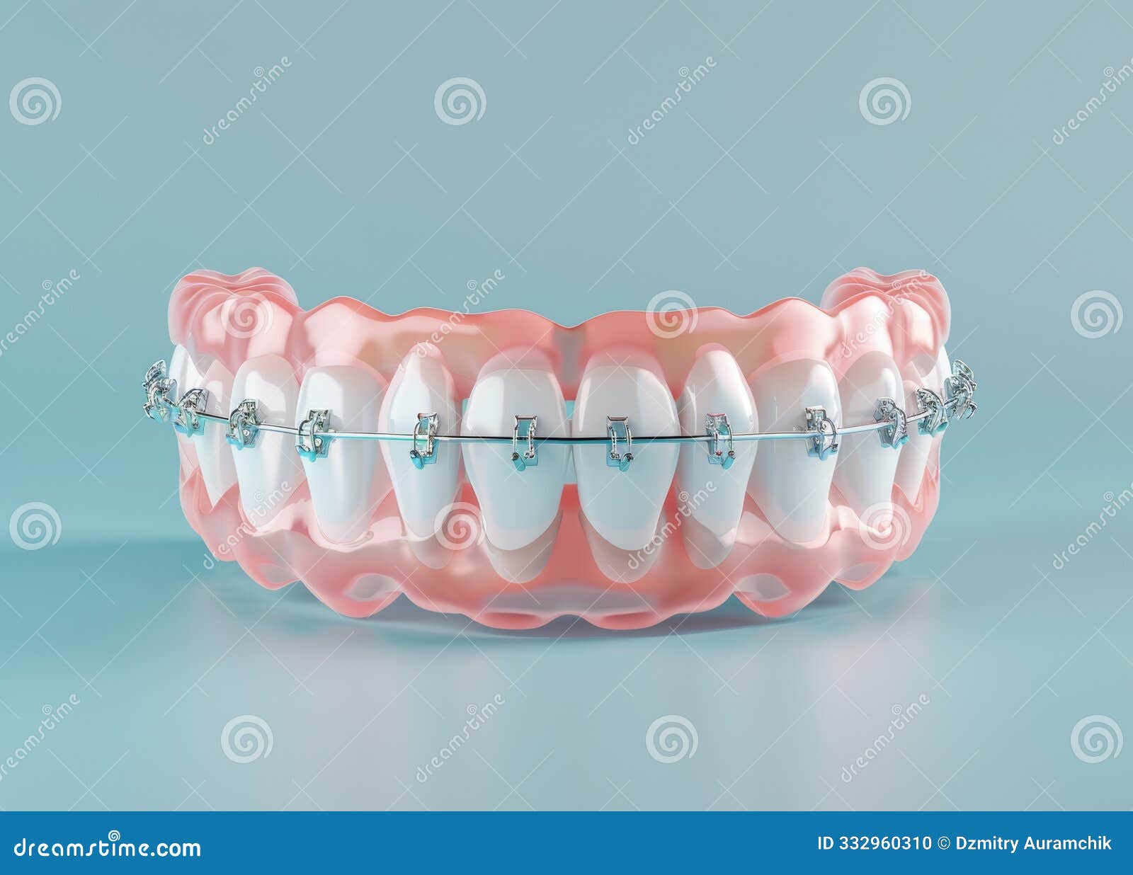 Makes Bite Correction with Invisible Retainer. Medically Accurate 3D ...