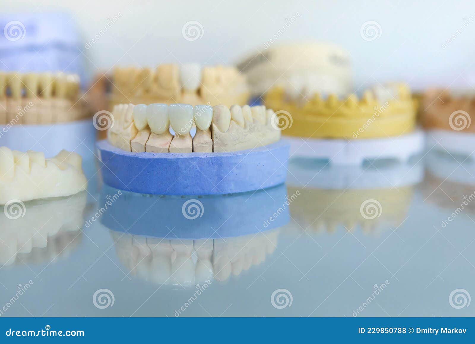 Making Dental Implants. Dental Laboratory Stock Photo - Image of ...