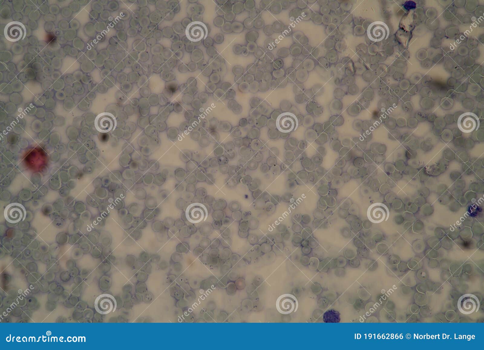 Malaria Parasites in Red Blood Cells 400x Stock Photo - Image of germs ...