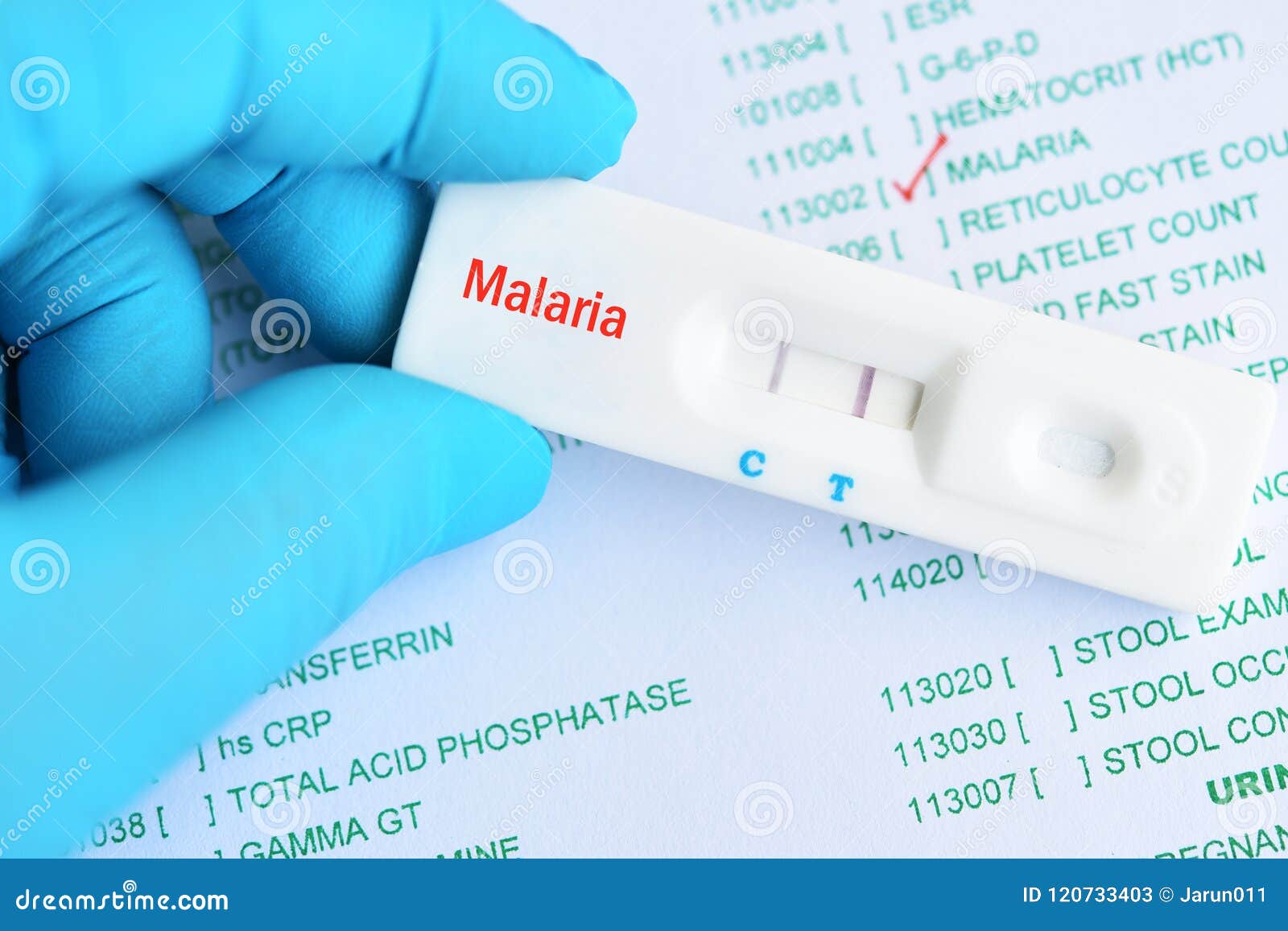 Malaria Positive Test Result Stock Image - Image of malariae, blood ...