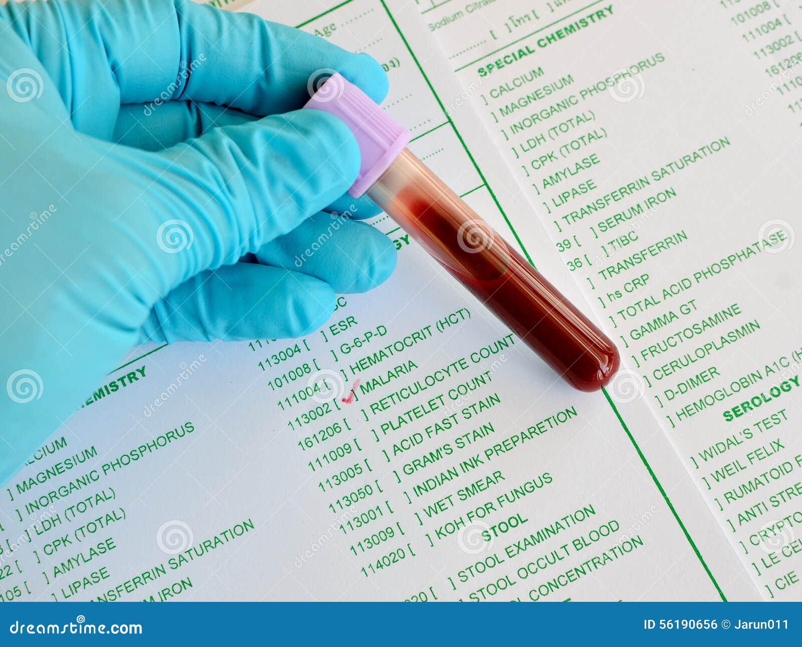 Malaria testing stock photo. Image of research, patient - 56190656