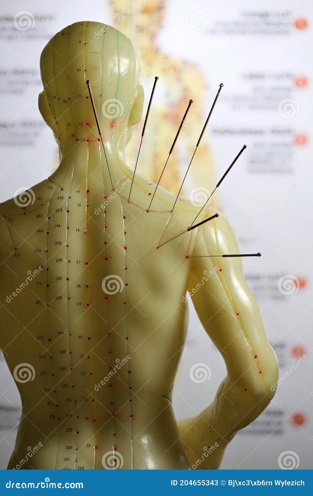 Male acupuncture model stock image. Image of naturopathy - 204655343