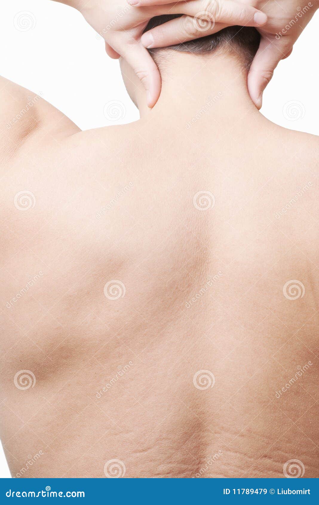 Male Back with Stretch Marks Stock Image - Image of masculine ...