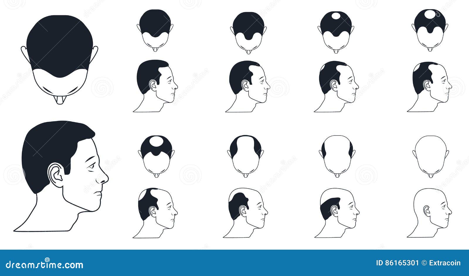 Baldspot Cartoons, Illustrations & Vector Stock Images - 226 Pictures ...