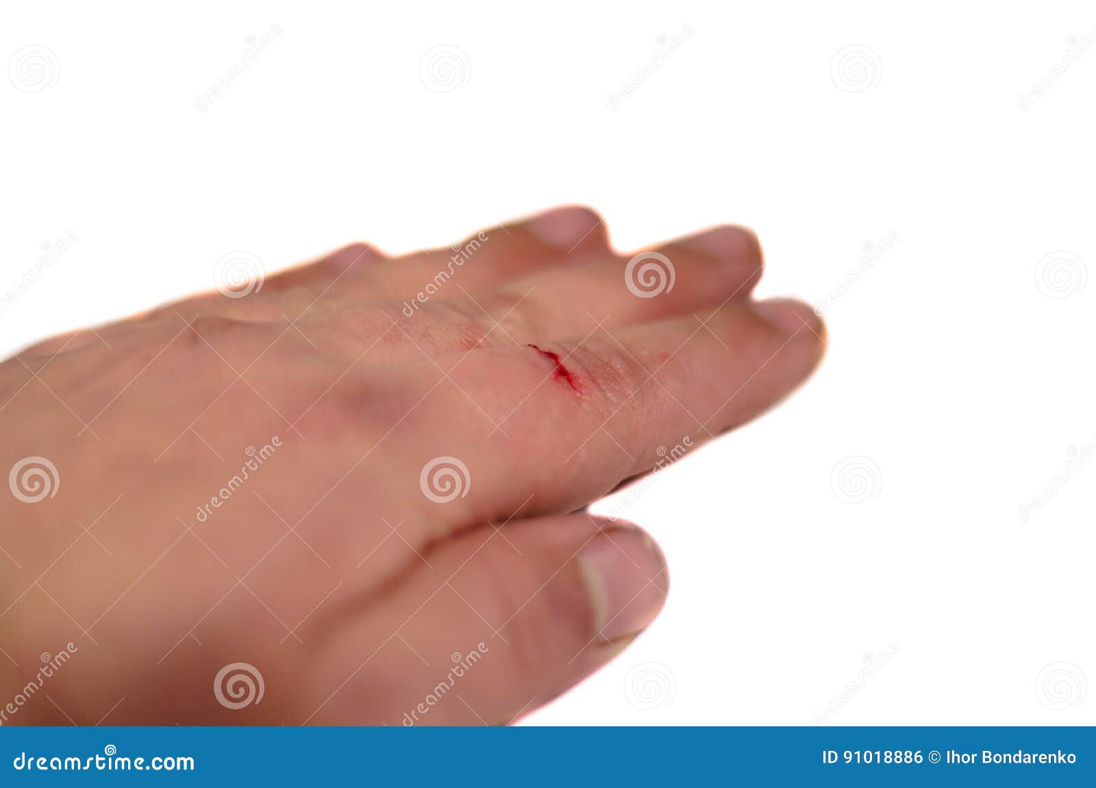 Male Hand with Bleeding Finger Isolated on White Background Stock Photo ...