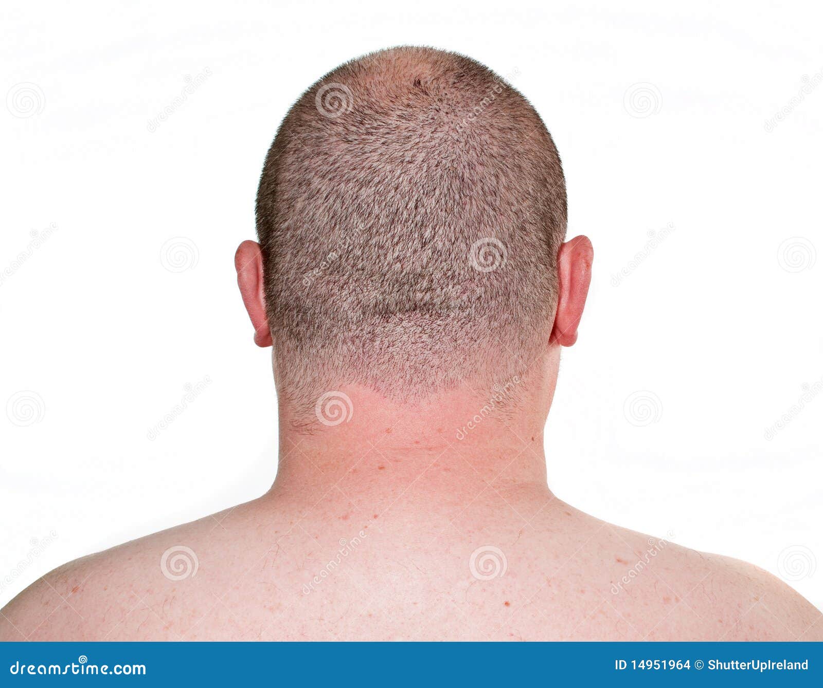 Male Head Close Up from Behind Stock Photo - Image of skin, ears: 14951964